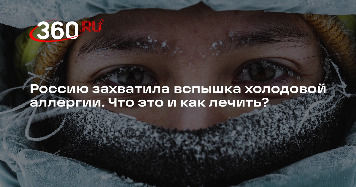 Аллергия на холод: что это, симптомы, как лечить | 360.ru