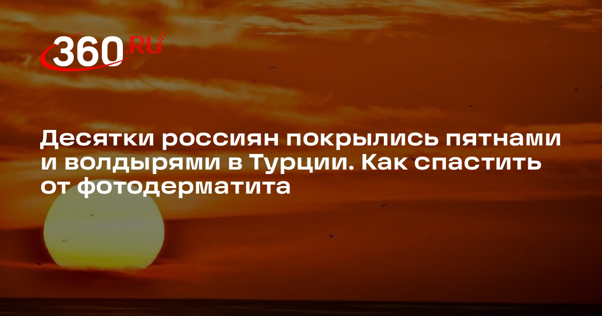 Аллергия на солнце или фотодерматит: что это такое, симптомы и ...